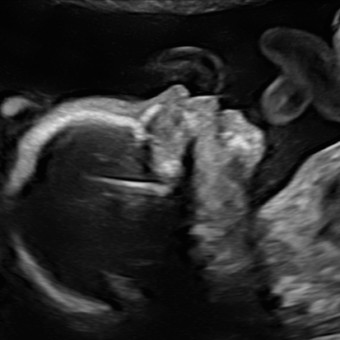 Victoria Quinlan and Patrice St-Amour’s Baby Registry at Babylist