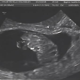 Taylor and Dylan Baize’s Baby Registry at Babylist